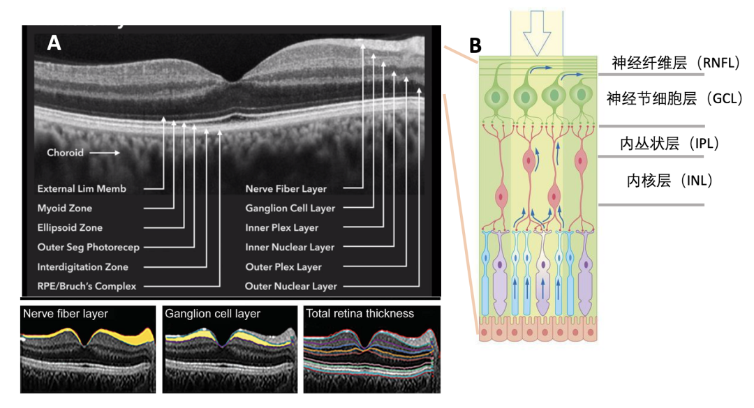“医生，我的OCT报告图正常吗？”-以眼观脑，浅析OCT-今日头条